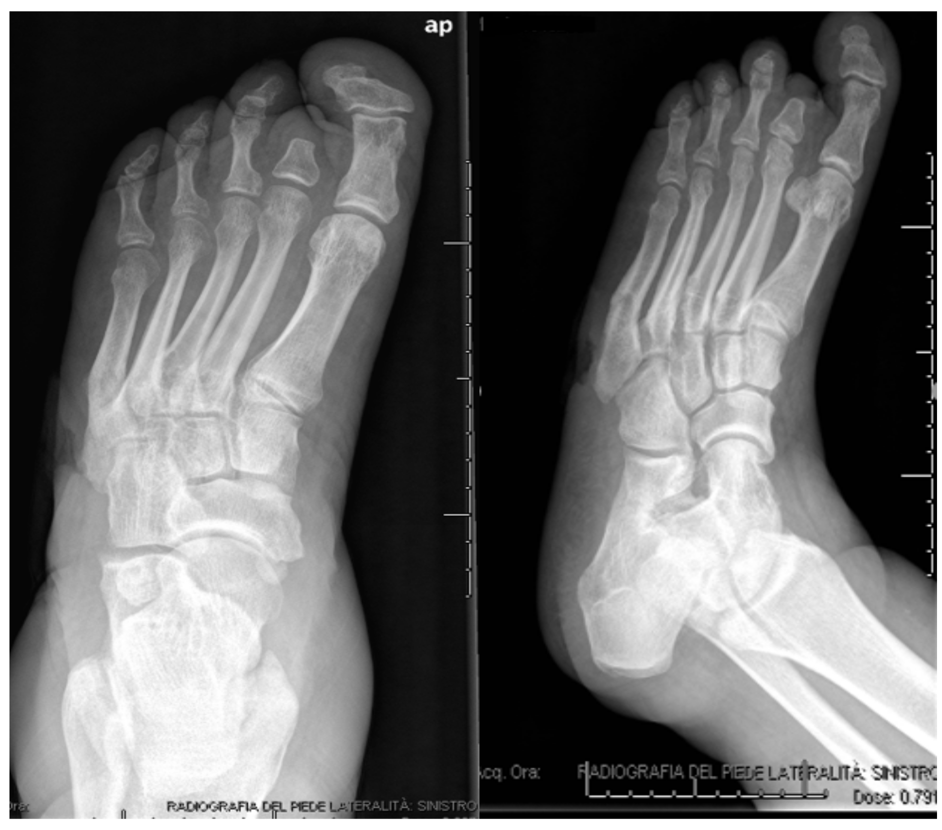 Multidisciplinary Approach for the Management and Treatment of Diabetic ...