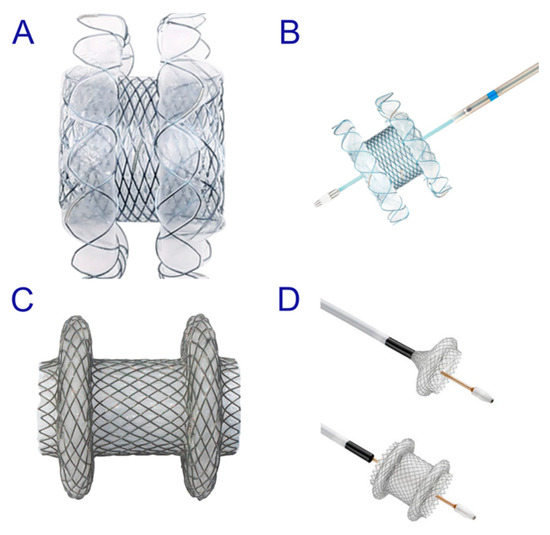 Which Are the Most Suitable Stents for Interventional Endoscopic ...