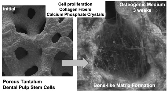 JCM | Free Full-Text | Porous Tantalum vs. Titanium Implants: Enhanced ...