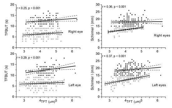 The Association between Tear Film Thickness as Measured with OCT and ...