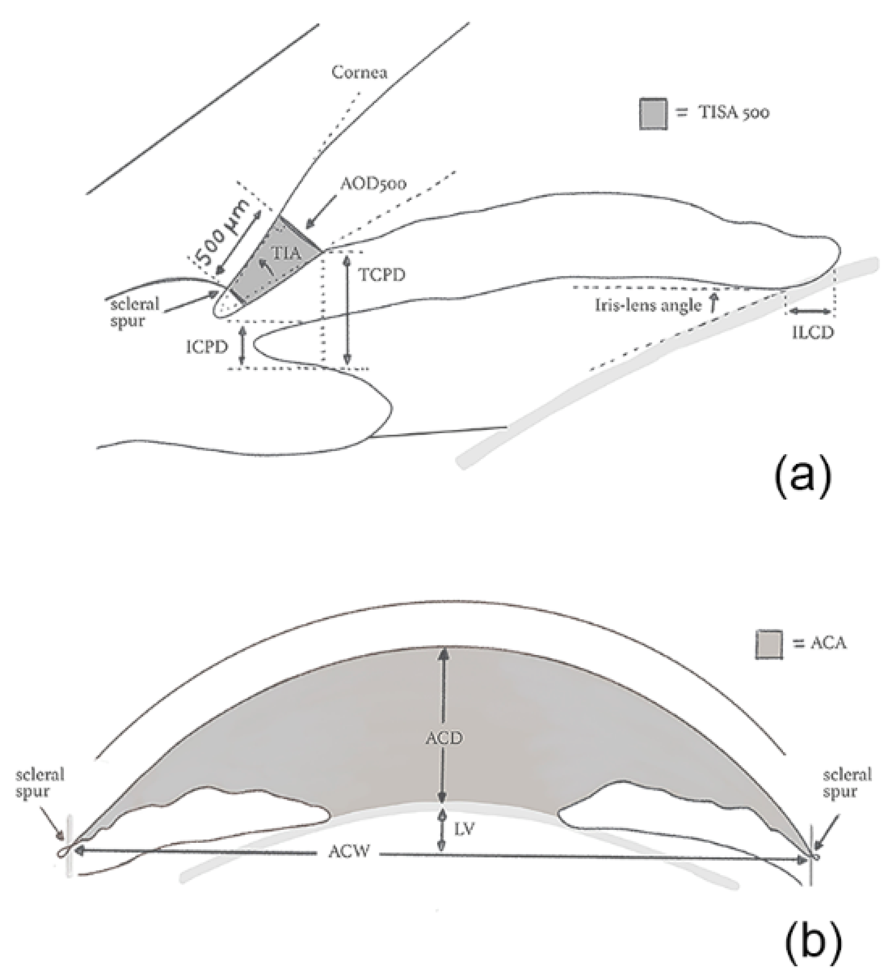 Anterior Chamber Angle