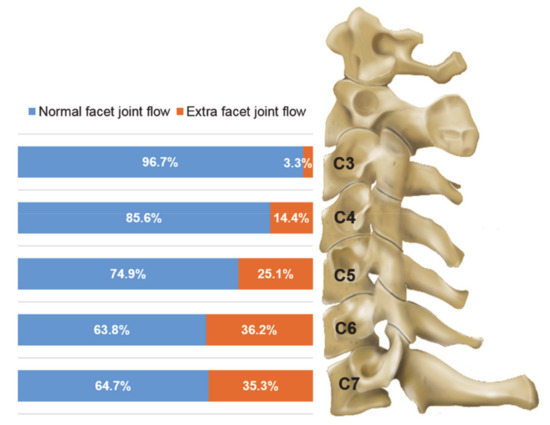 Fluoroscopic Findings of Extra-Cervical Facet Joint Flow and Its ...
