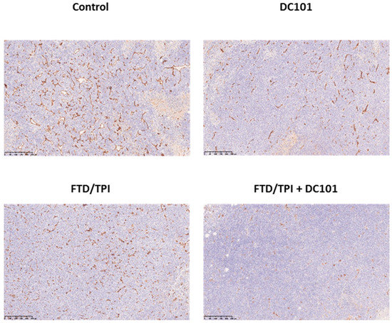 Efficacy of Combination Chemotherapy Using a Novel Oral ...