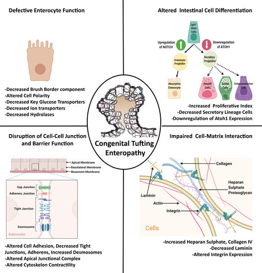JCM | Free Full-Text | Congenital Tufting Enteropathy: Biology ...