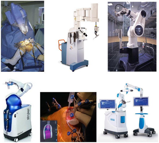 New Technologies in Knee Arthroplasty: Current Concepts