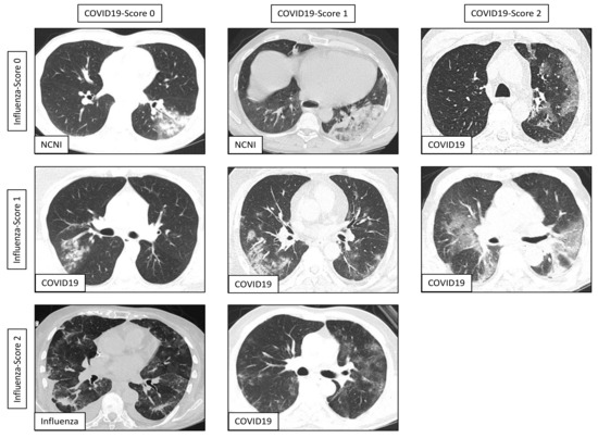 COVID-19 Pandemic and Upcoming Influenza Season—Does an Expert’s ...