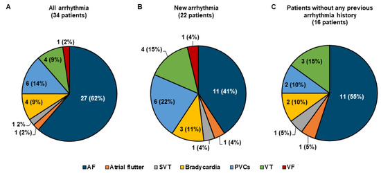 Predictors and Prognostic Implications of Cardiac Arrhythmias in ...