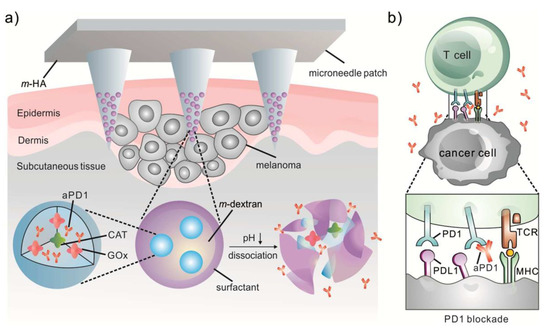 Microneedle Arrays Combined with Nanomedicine Approaches for ...