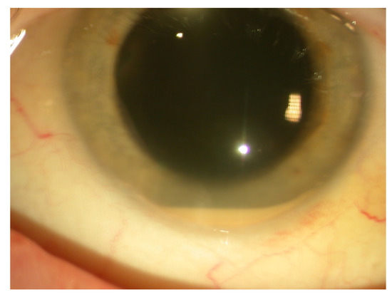 JCM | Special Issue : Diagnosis and Management of Non-infectious ...