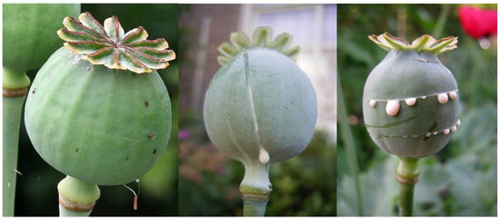 Opioids and Sickle Cell Disease: From Opium to the Opioid Epidemic