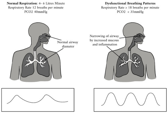 Breathing Re-Education and Phenotypes of Sleep Apnea: A Review