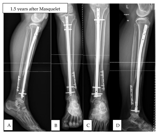 Expression of VEGF in Peripheral Serum Is a Possible Prognostic Factor ...