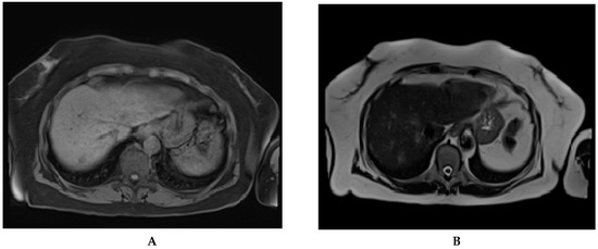 Ultrasound or Sectional Imaging Techniques as Screening Tools for ...