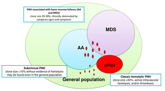 Difficult Cases of Paroxysmal Nocturnal Hemoglobinuria: Diagnosis and ...