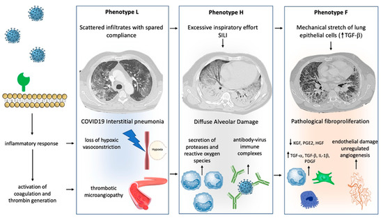 Spontaneous Breathing and Evolving Phenotypes of Lung Damage in ...