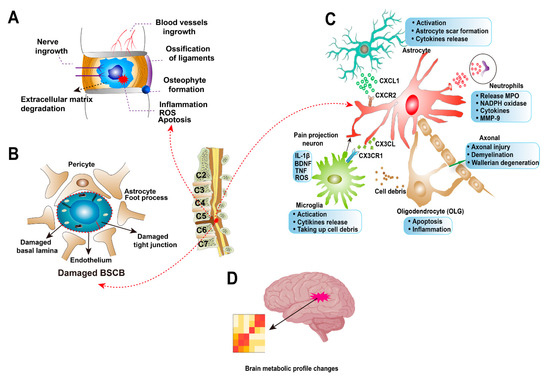 Degenerative Cervical Myelopathy: Insights into Its Pathobiology and ...