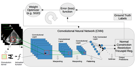 Artificial Intelligence (AI)-Empowered Echocardiography Interpretation ...