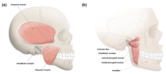 MRI-Based Assessment of Masticatory Muscle Changes in TMD Patients ...
