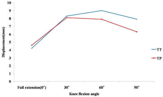 Biomechanical Difference between Conventional Transtibial Single-Bundle ...