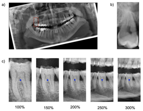 Impact of Image Context on Deep Learning for Classification of Teeth on ...