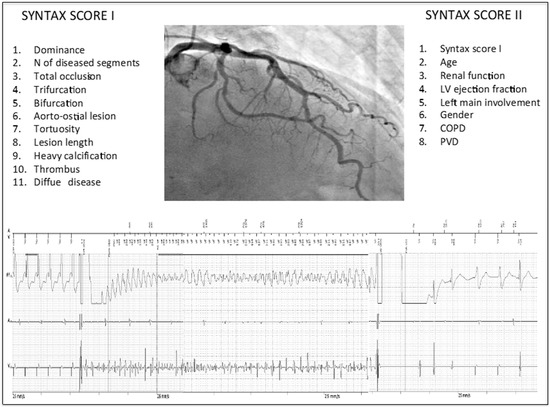 JCM | Special Issue : Clinical Updates in the Management of Ventricular ...