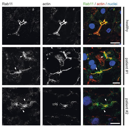 Advanced Microscopy for Liver and Gut Ultrastructural Pathology in ...