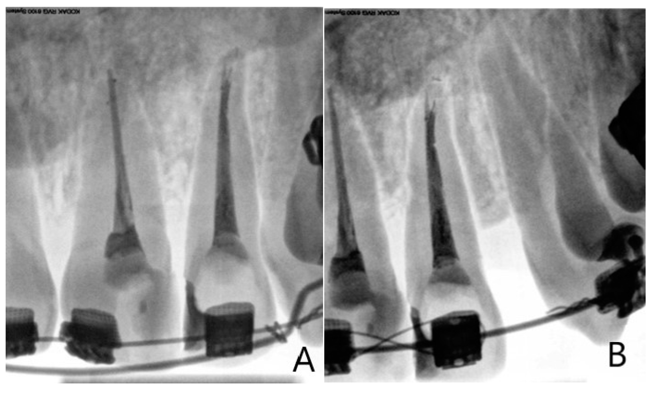 The Radiological Assessment of Root Features and Periodontal Structures ...