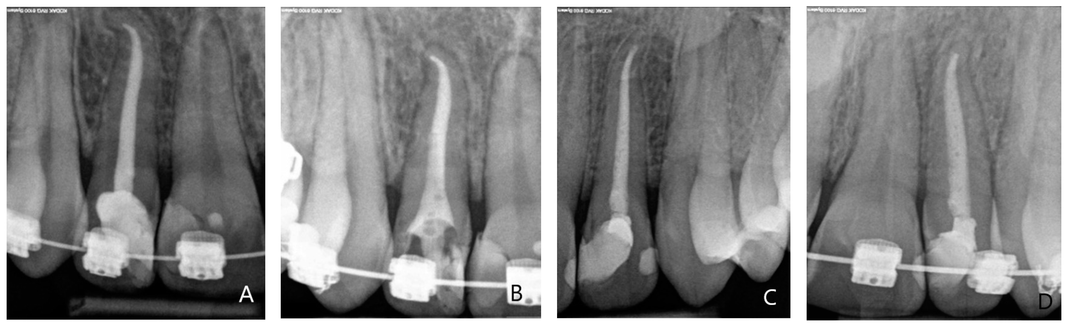 JCM | Free Full-Text | The Radiological Assessment of Root Features and Periodontal Structures ...