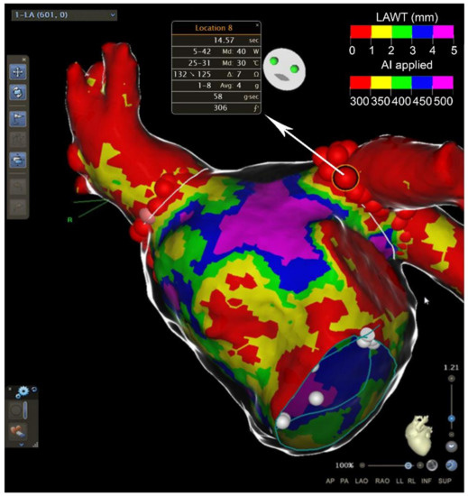 Imaging Techniques for the Study of Fibrosis in Atrial Fibrillation ...