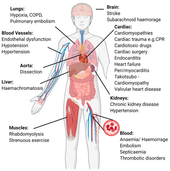 Diagnosis, Investigation and Management of Patients with Acute and ...