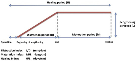 Bone Lengthening with a Motorized Intramedullary Nail in 34 Patients ...