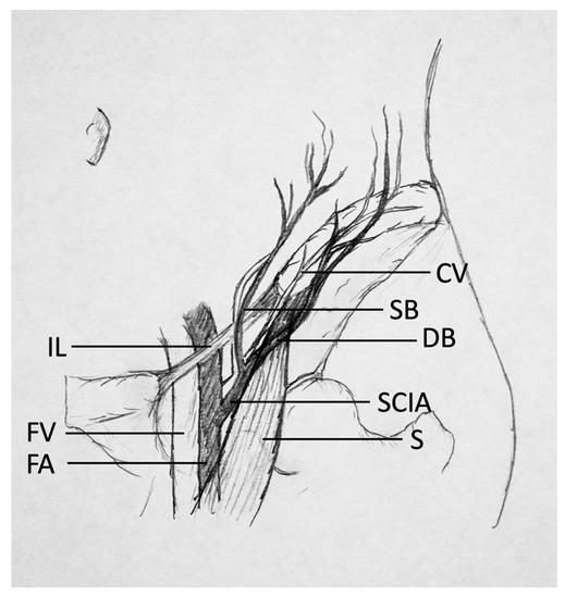 Do-It-Yourself Preoperative High-Resolution Ultrasound-Guided Flap ...