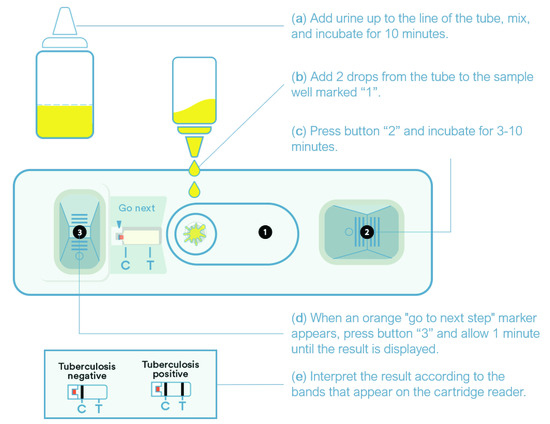 Fujifilm SILVAMP TB-LAM for the Diagnosis of Tuberculosis in Nigerian ...