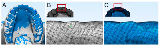 Robot-Assisted Maxillary Positioning in Orthognathic Surgery: A ...