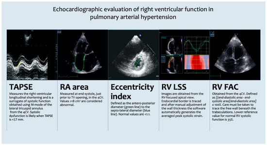 JCM | Free Full-Text | Echocardiography in Pulmonary Arterial ...