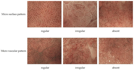 Fundamentals, Diagnostic Capabilities, and Perspective of Narrow Band ...