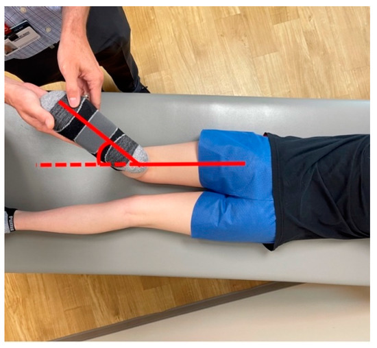JCM | Free Full-Text | Coronal and Transverse Malalignment in Pediatric ...