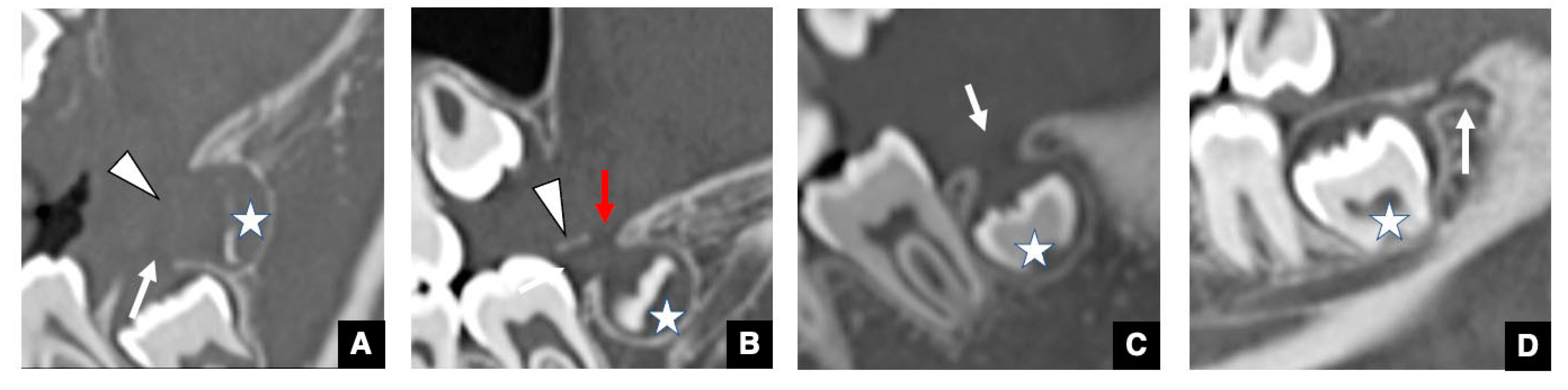 Overview of Radiological Studies on Visualization of Gubernaculum ...