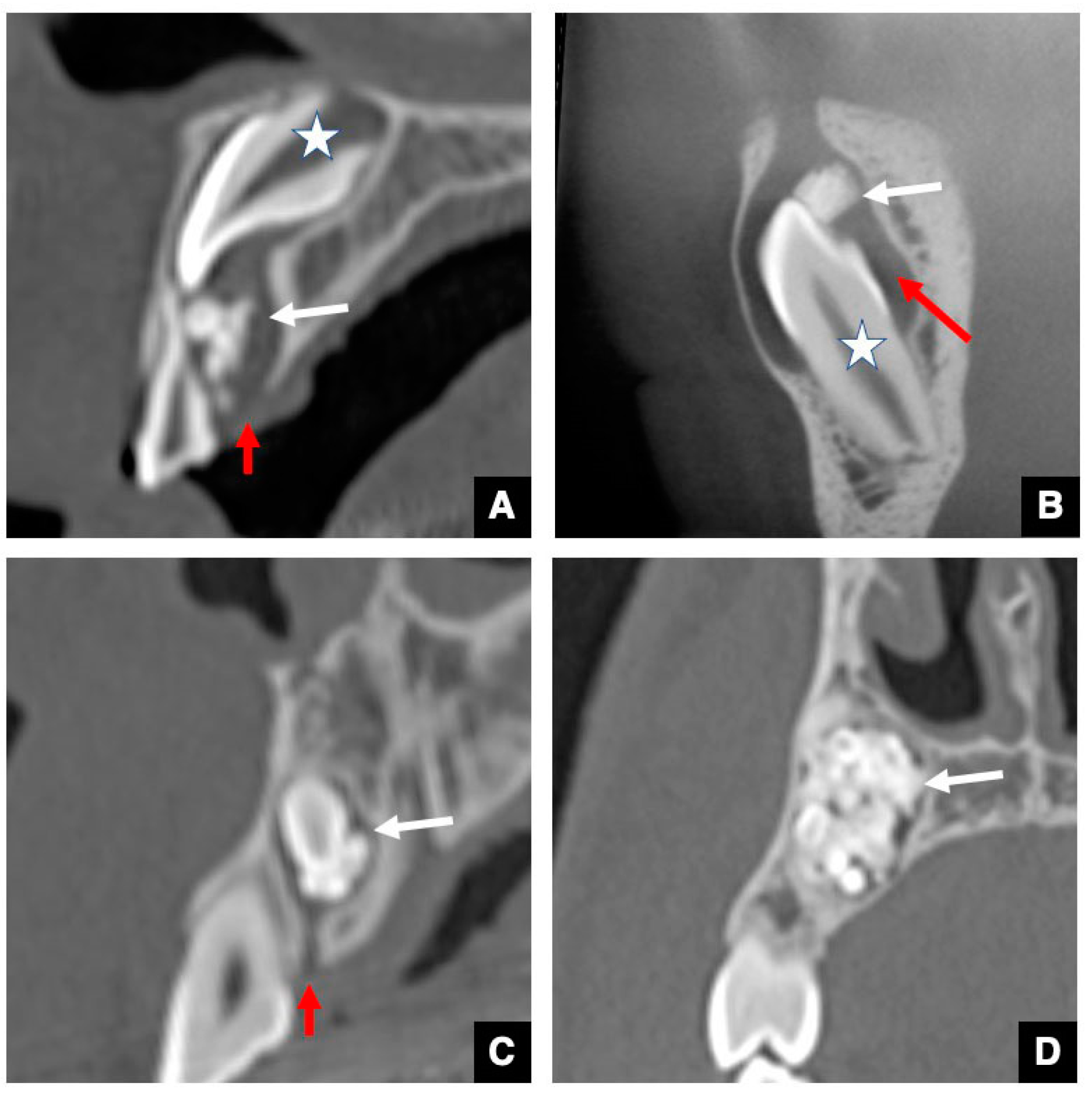 Overview of Radiological Studies on Visualization of Gubernaculum ...