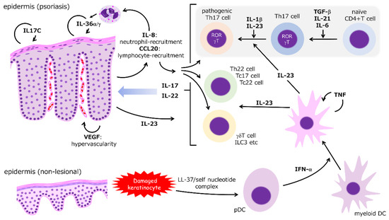 JCM | Free Full-Text | Molecular Pathogenesis of Psoriasis and Biomarkers Reflecting Disease ...