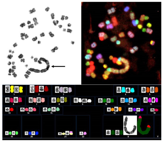 Biology and Management of Dedifferentiated Liposarcoma: State of the Art and Perspectives