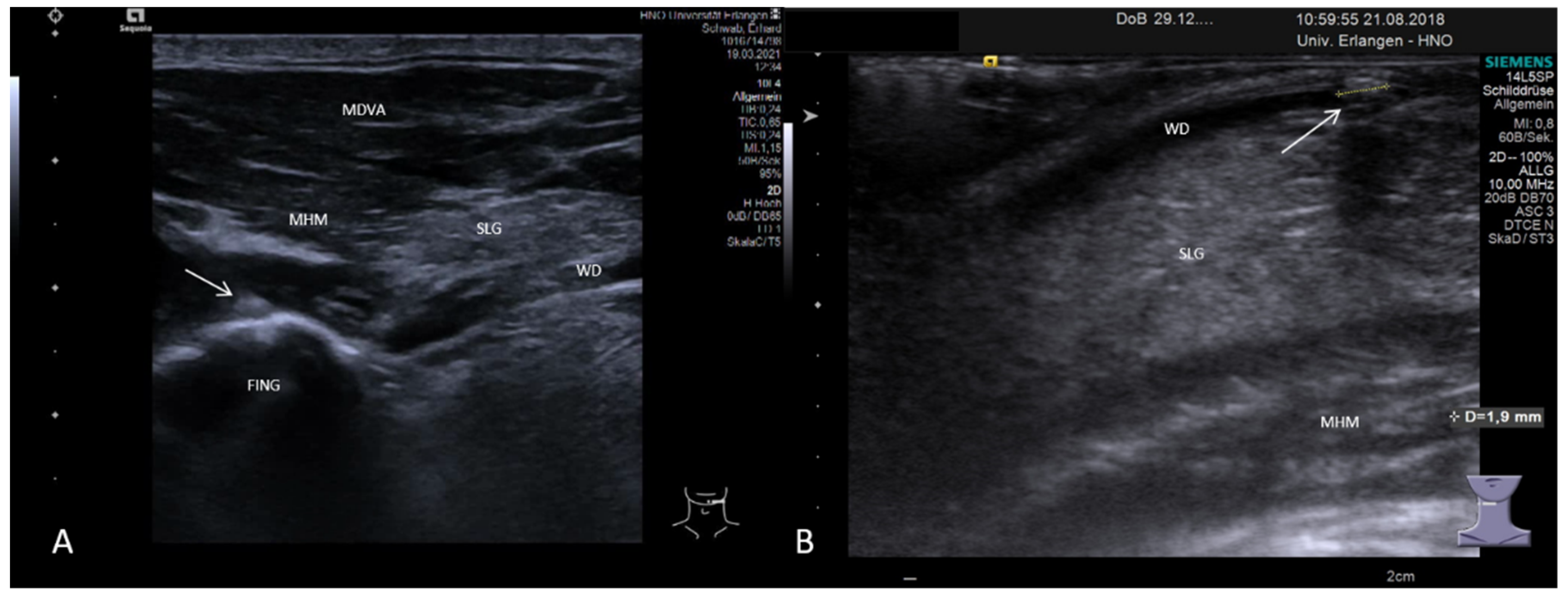 Jcm Free Full Text Ultrasound In Inflammatory And Obstructive