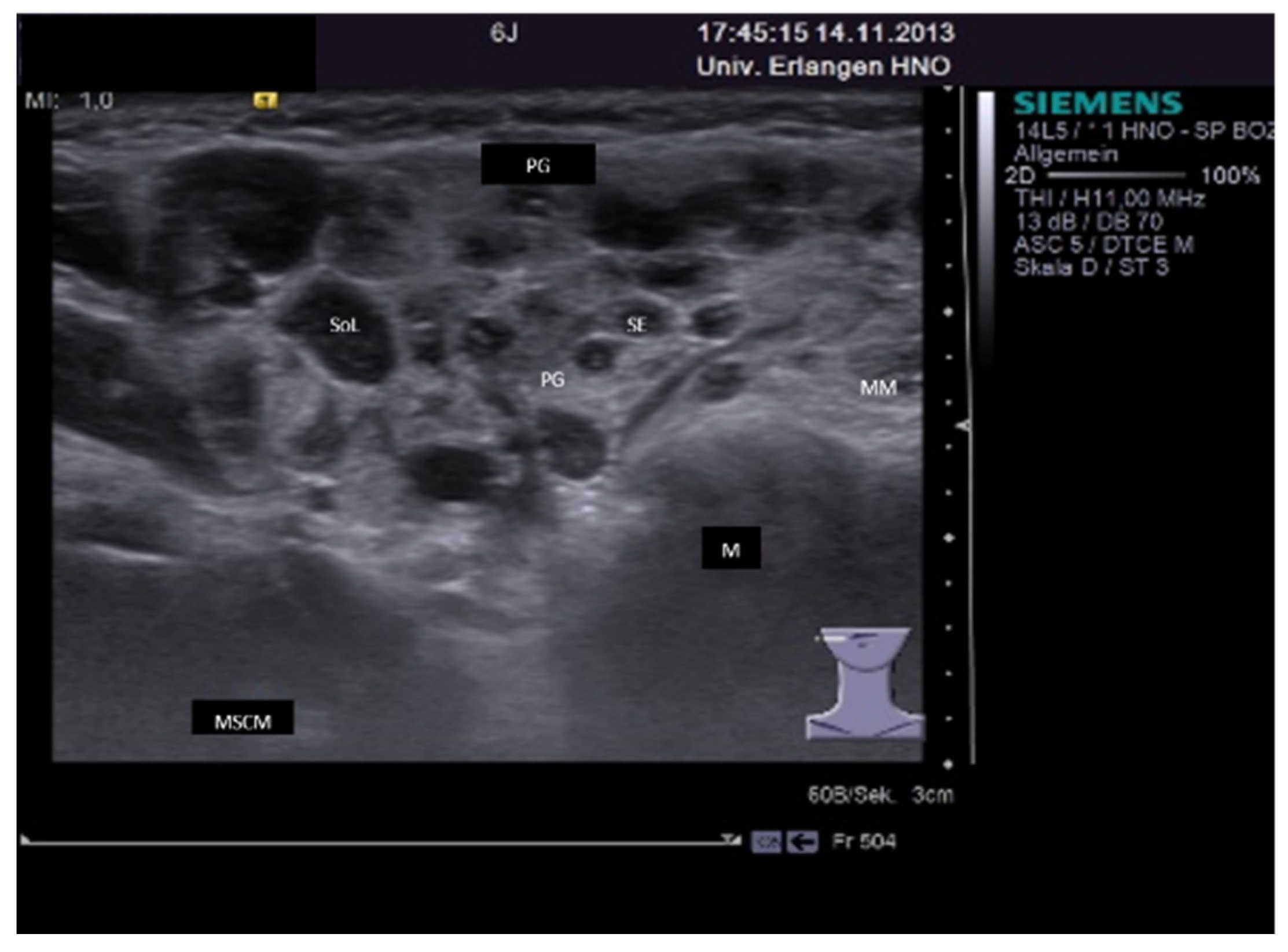 Jcm Free Full Text Ultrasound In Inflammatory And Obstructive