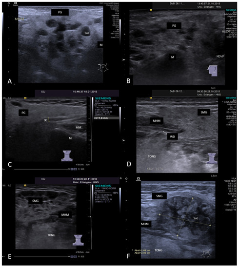 Jcm Free Full Text Ultrasound In Inflammatory And Obstructive