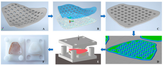 A Multi-Criteria Assessment Strategy for 3D Printed Porous Polyetheretherketone (PEEK) Patient ...
