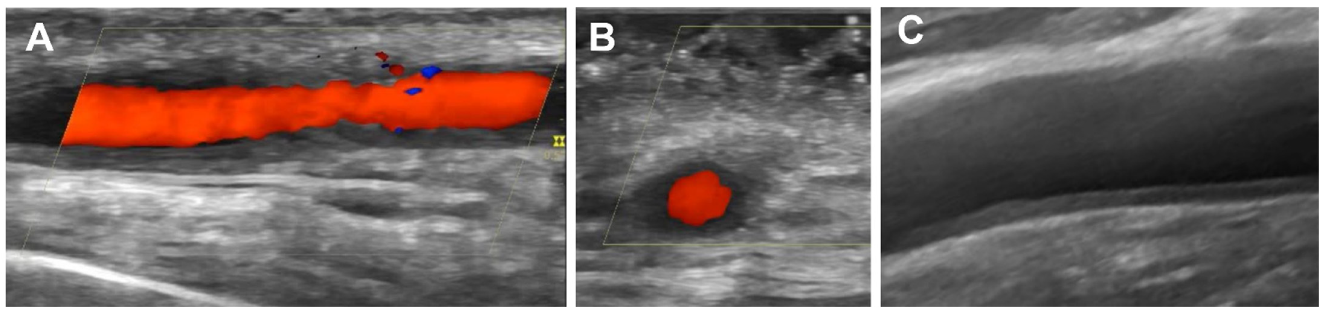 JCM | Free Full-Text | Imaging Tests in the Early Diagnosis of Giant ...