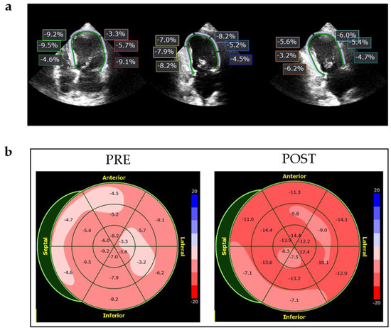 Echocardiographic Evaluation of LV Function in Patients with ...