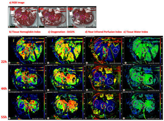 Hyperspectral Imaging and Machine Perfusion in Solid Organ ...