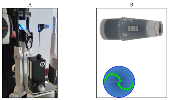 How to Measure Intraocular Pressure: An Updated Review of Various ...