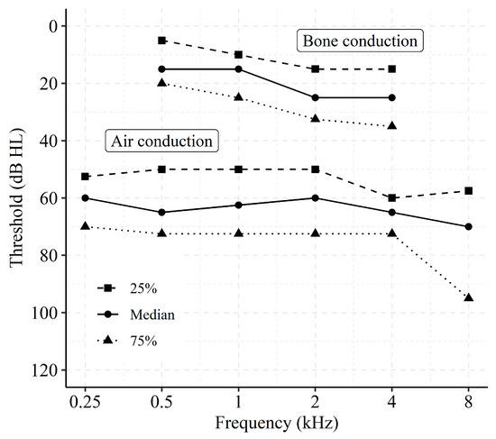 Investigating Real-World Benefits of High-Frequency Gain in Bone ...
